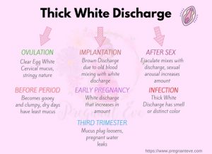 Thick White Discharge: Types, Causes & Treatment